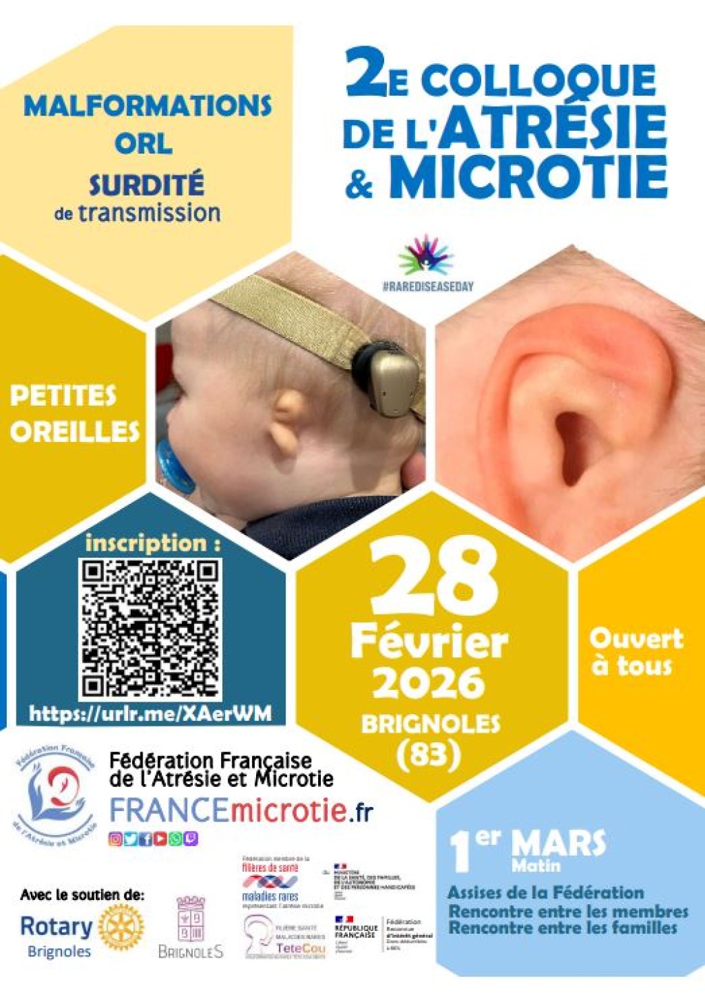 Colloque : L'atrésie et microtie : Conférence à Brignoles (28 fev 2026)